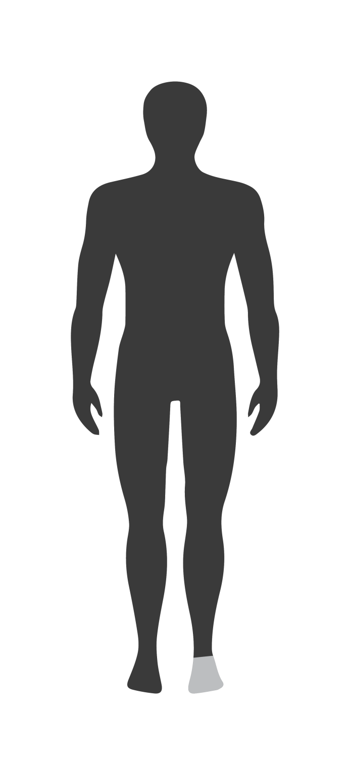 Types of Prosthetic Legs | ForMotion Clinics