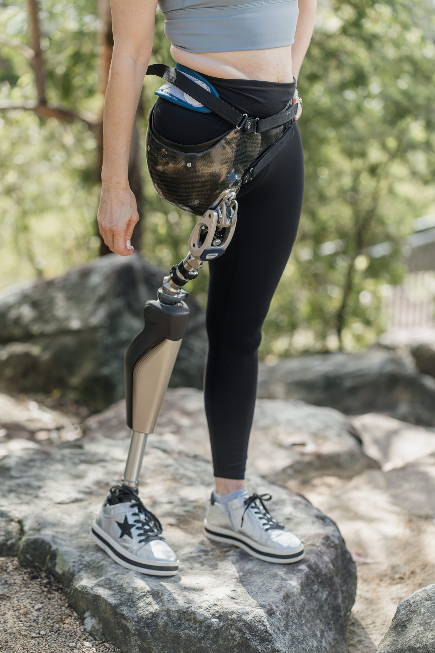 Types of Prosthetic Legs | ForMotion Clinics