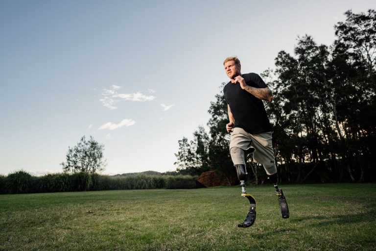 Types of Prosthetic Legs | ForMotion Clinics