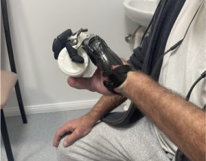 Types of Prosthetic Legs | ForMotion Clinics